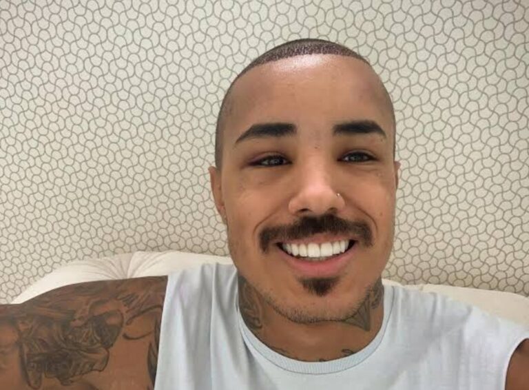 Cantor Livinho surge com rosto completamente deformado e gera extremo ...