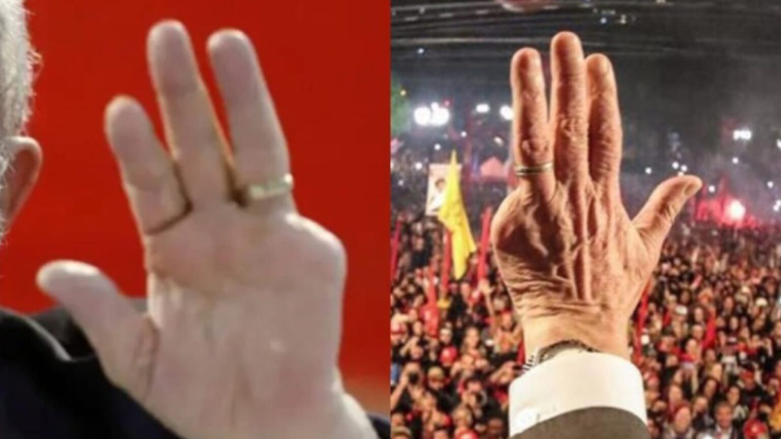 Conheça a chocante história por trás do dedo 'amputado' do ex ...