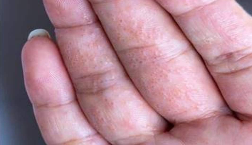 Mao Cheia De Furos - FDPLEARN