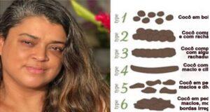 Através do formato de suas fezes que Preta Gil descobriu que estava com ...